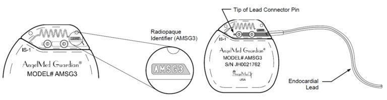 Implantable Loop Recorders (ILRs) or Insertable Cardiac Monitor (ICMs ...