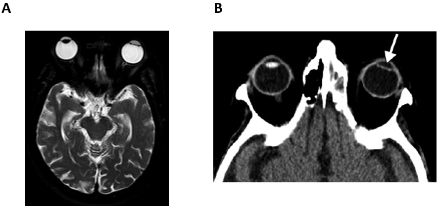 figure2 – NHS GGC MRI Physics