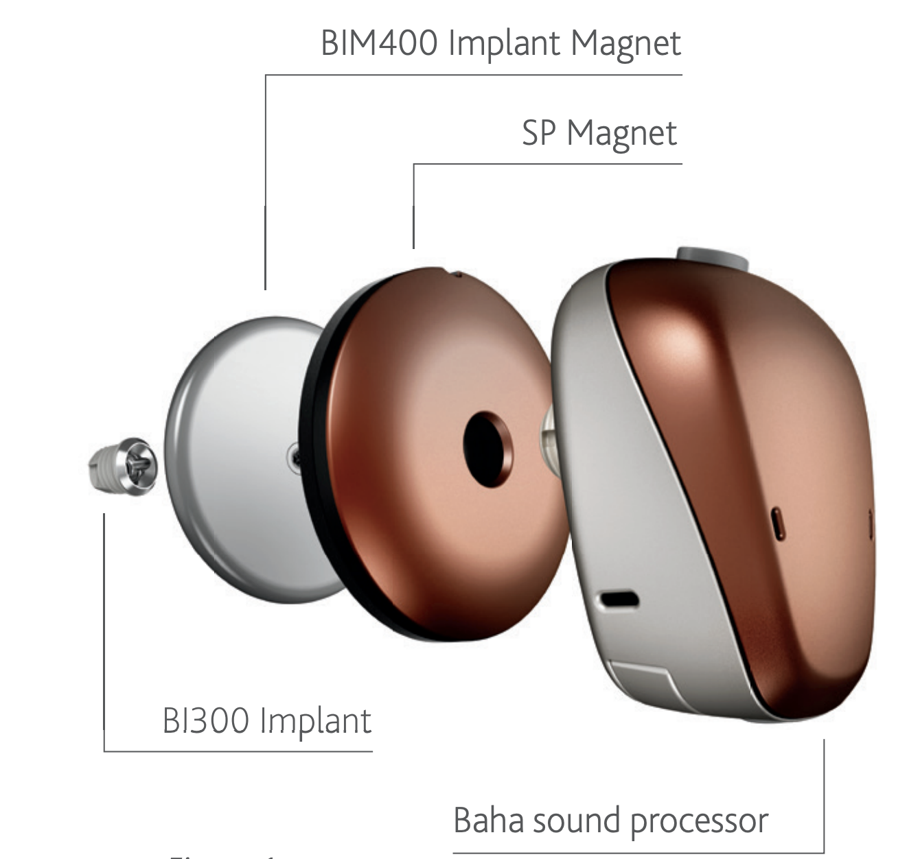 BAHA (Bone-Anchored Hearing Aid) – NHS GGC MRI Physics