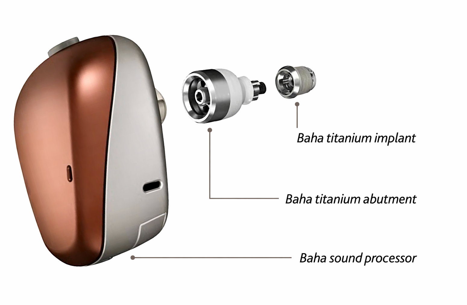 BAHA (Bone-Anchored Hearing Aid) – NHS GGC MRI Physics